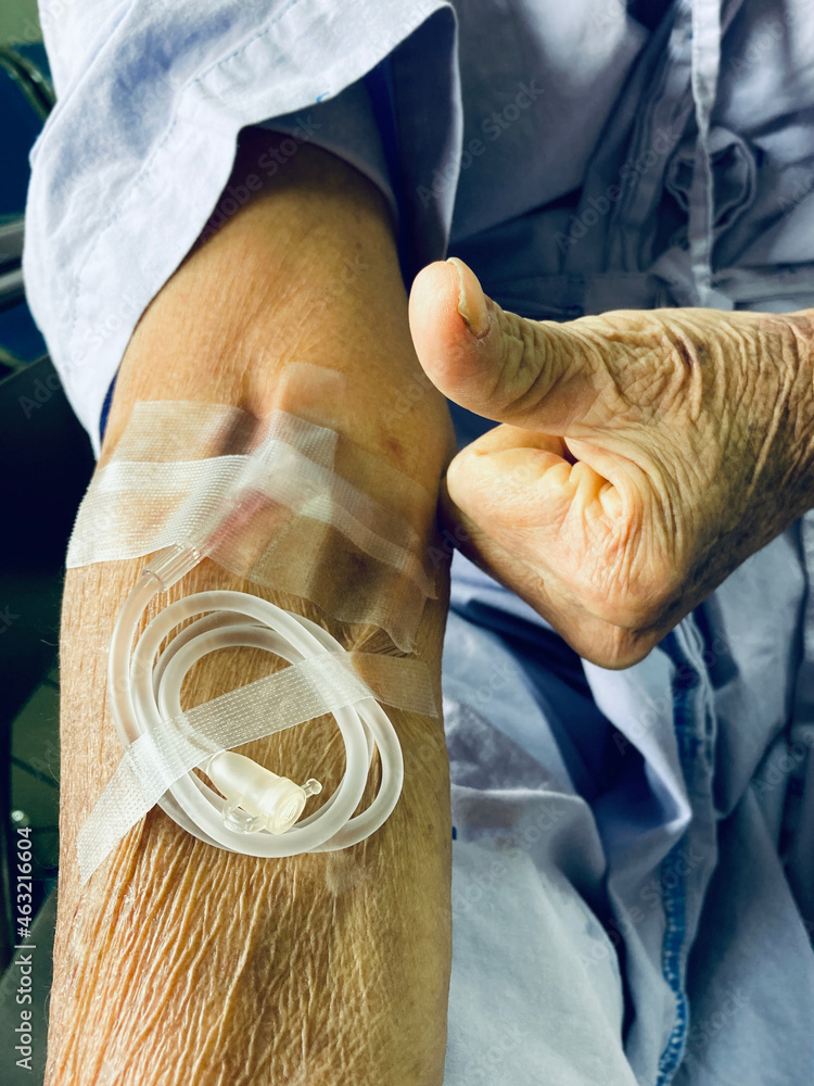 Extension Tube for peripheral venous cannulation on the arm of an ...