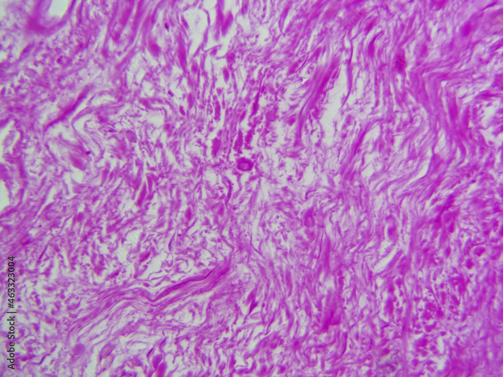 Histology microscope image of dense irregular connective tissue proper ...
