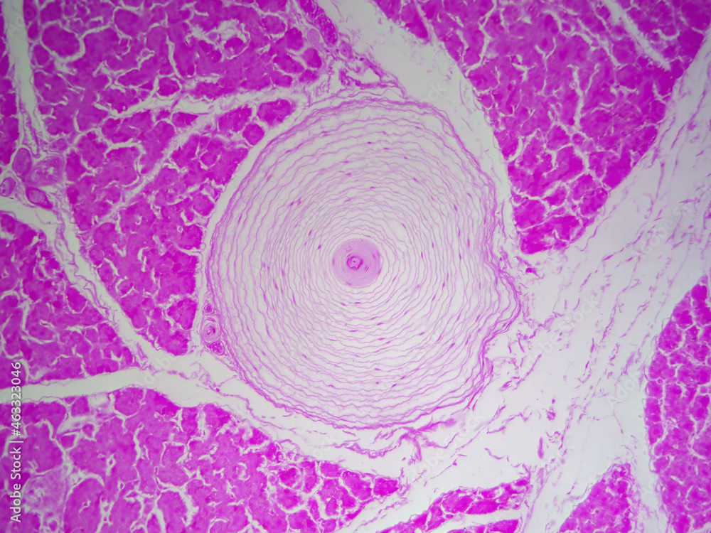 Histology microscope image of Pacinian corpuscle of the dermis in skin ...
