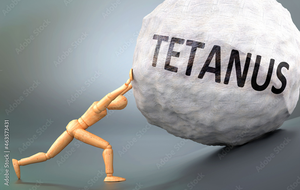 Tetanus - depiction, impression and presentation of this condition ...