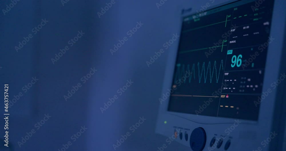 Wideo Stock: In the operating room of a hospital, a heart rate monitor ...