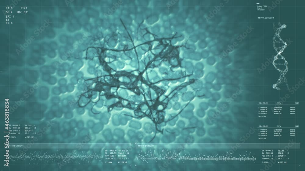 Cells in liqiuid under microscope. Virus infection, human cells ...