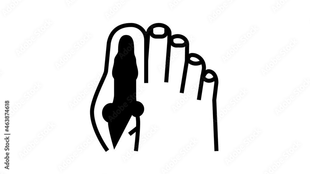 foot big toe bone gout animated line icon. foot big toe bone gout sign ...