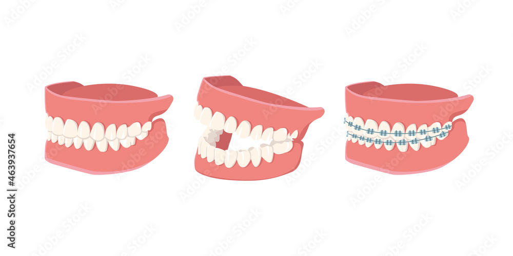 Human Jaw set isolated on white background. Opened, closed jaws and ...