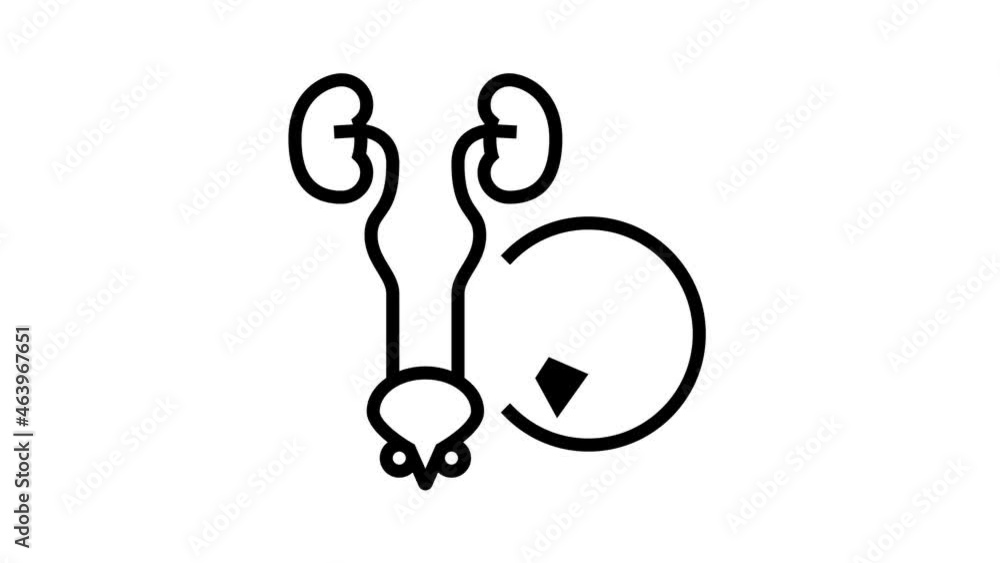 genitourinary system disease animated line icon. genitourinary system ...