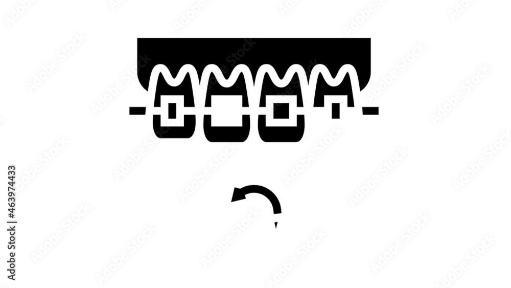 lingual tooth braces animated glyph icon. lingual tooth braces sign ...