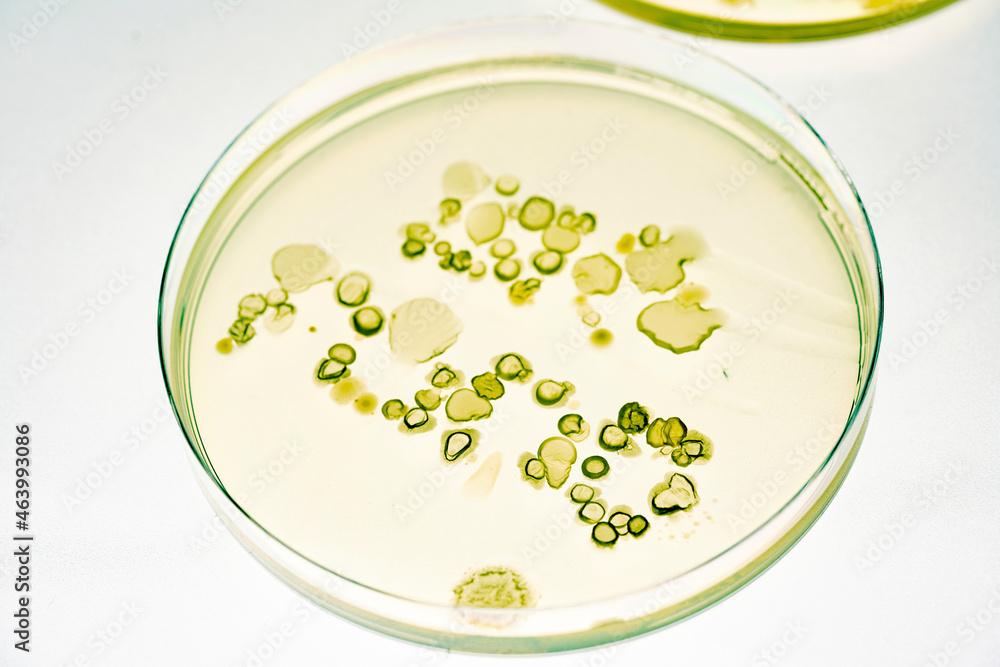 Bacterial colonies on agar plate Stock Photo | Adobe Stock