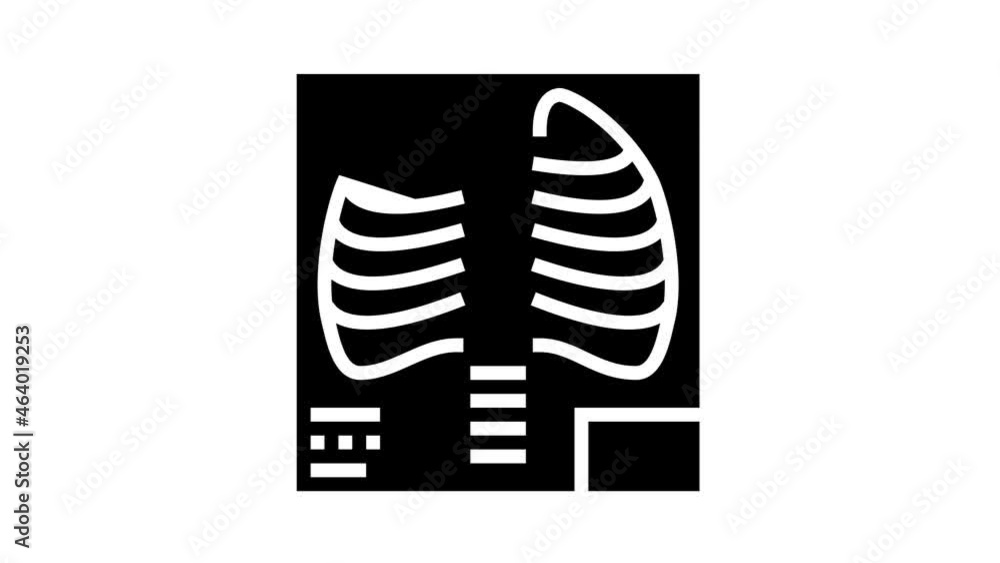 x-ray radiology animated glyph icon. x-ray radiology sign. isolated on ...