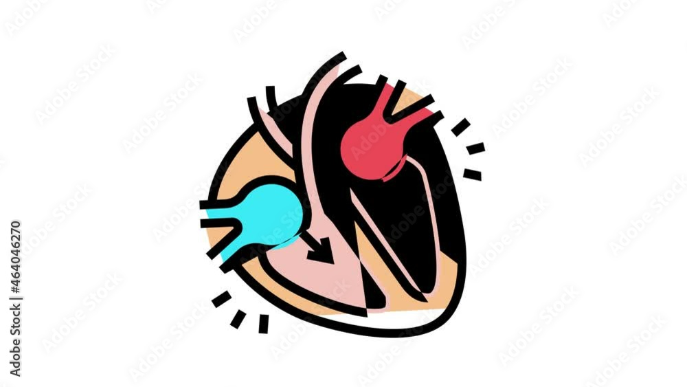 diastole disease animated color icon. diastole disease sign. isolated ...