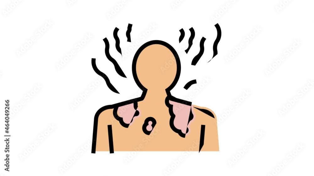 sunburn skin disease animated color icon. sunburn skin disease sign ...