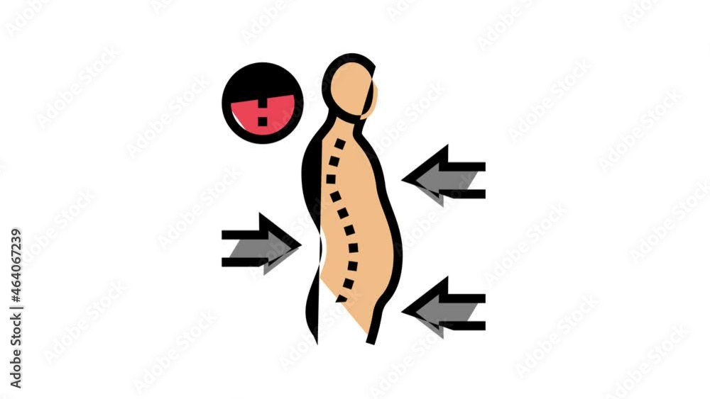 Vidéo Stock scoliosis disease animated color icon. scoliosis disease ...