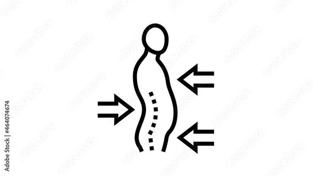scoliosis disease animated line icon. scoliosis disease sign. isolated ...