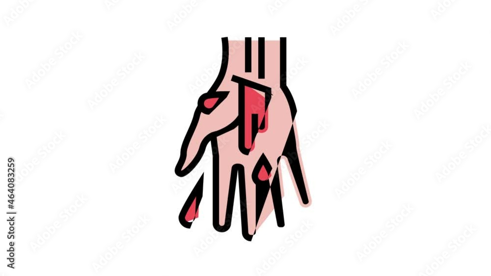 venous bleeding disease animated color icon. venous bleeding disease ...