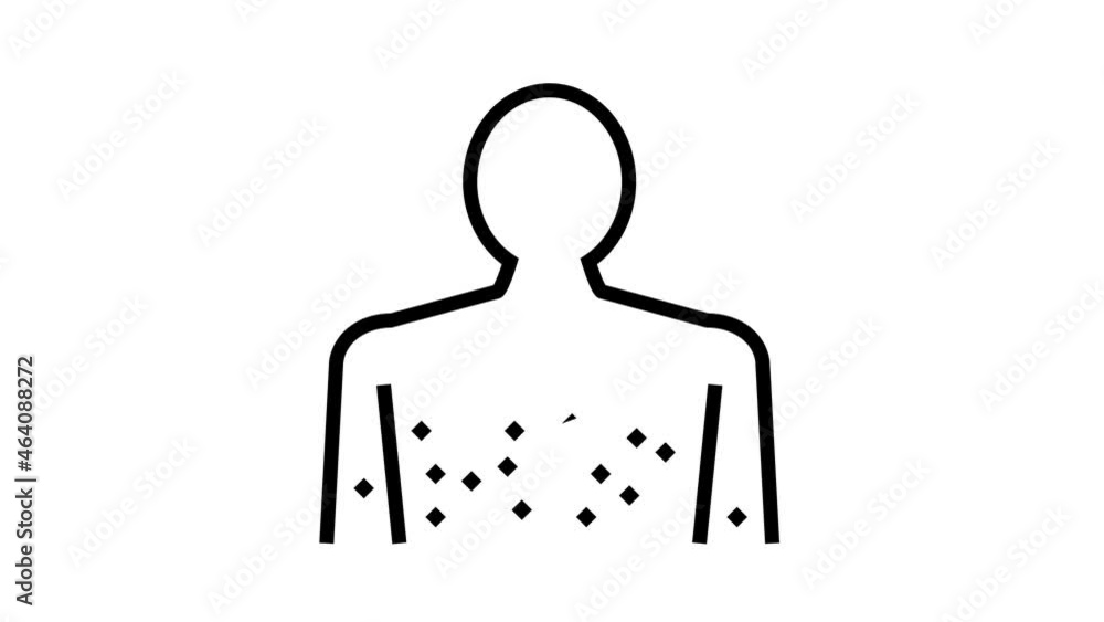 skin rash disease animated line icon. skin rash disease sign. isolated ...