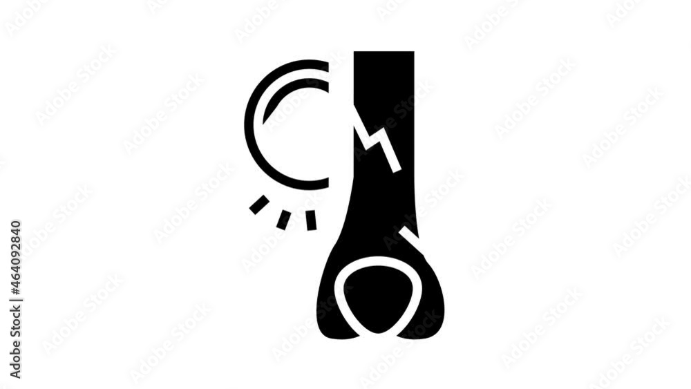 crack bone disease animated glyph icon. crack bone disease sign ...