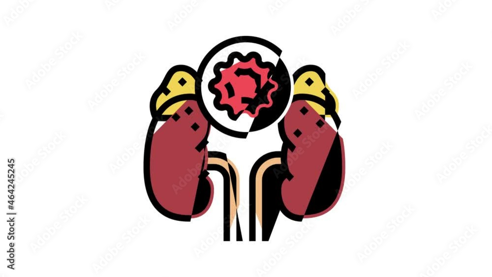 cushing cortisol syndrome animated color icon. cushing cortisol ...