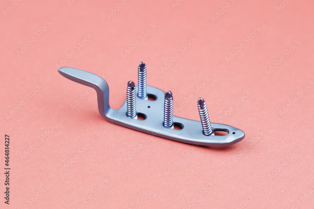 Surgical plate for osteosynthesis in case of bone fractures Stock Photo ...