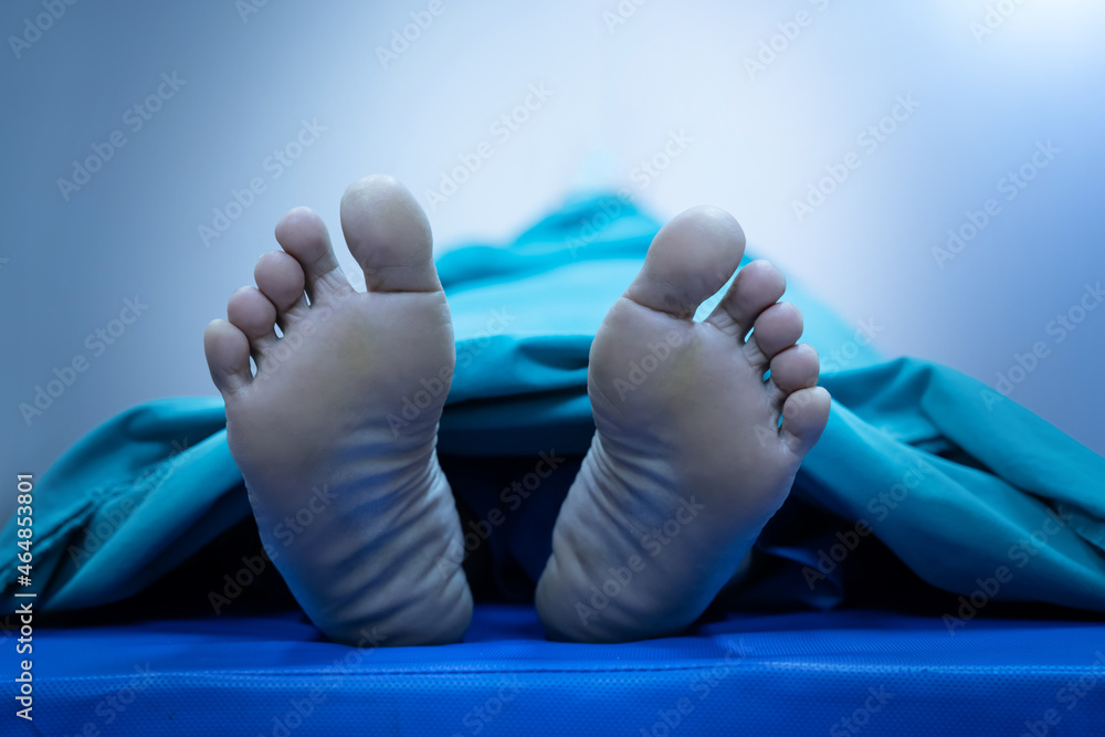 Dead Body's Feet Covered with Sheet without Tag on the Table Stock ...