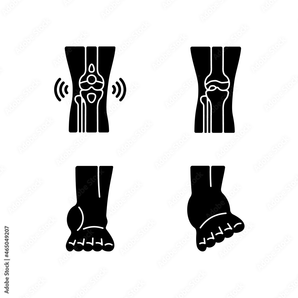 Arthritis leg pain black glyph icons set on white space. Degenerative ...