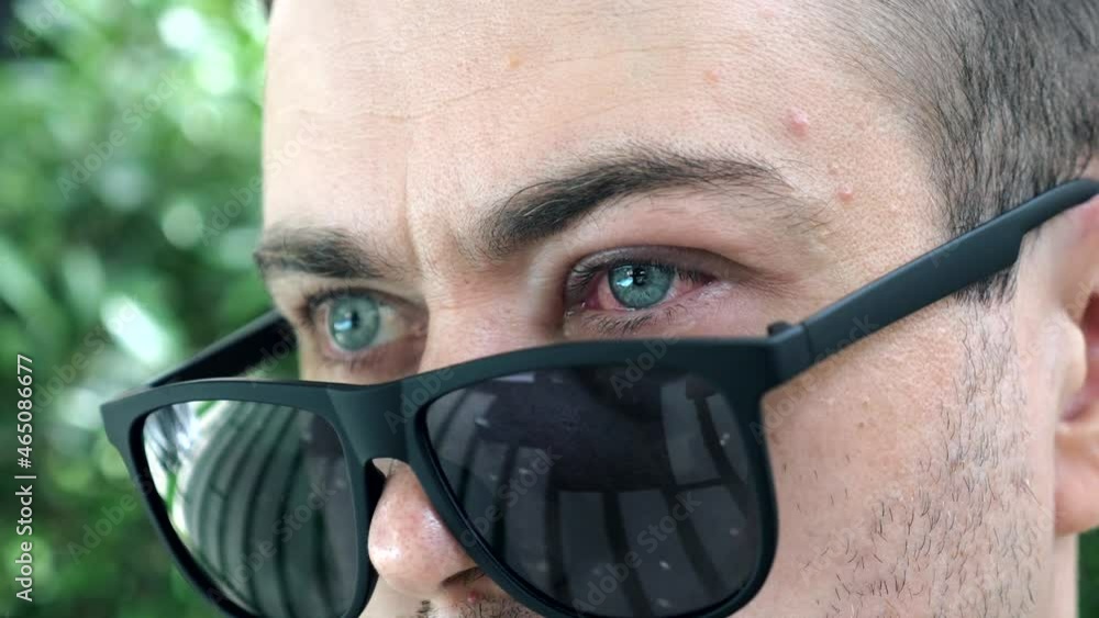 Close Up of Sad Man Pulls Down Black Sunglasses, Hiding Annoyed Injured ...