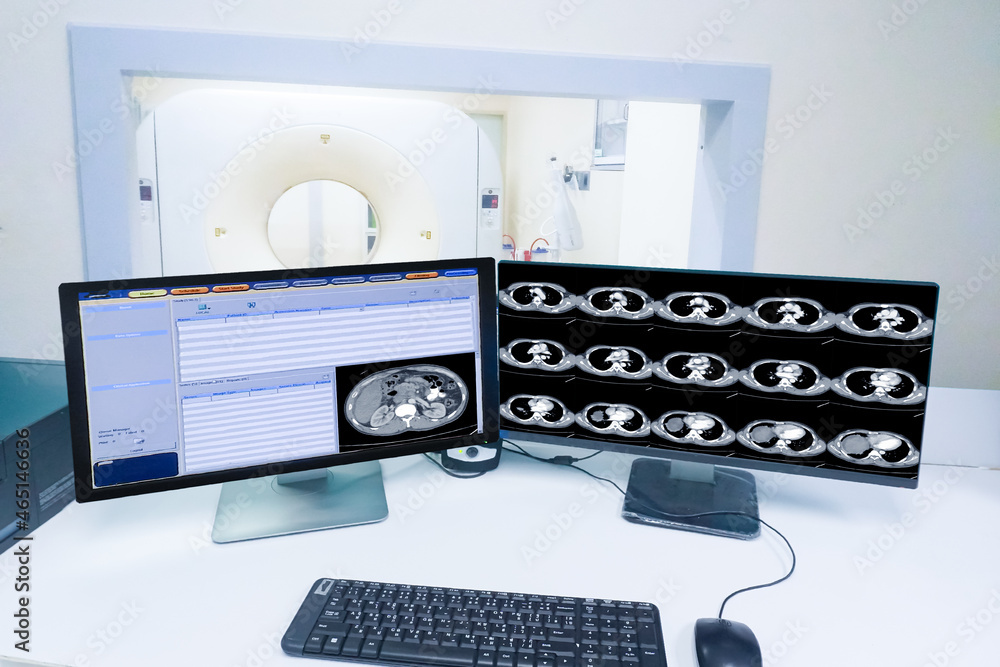 Computer monitor Scan control room and computer showing abdominal scan ...