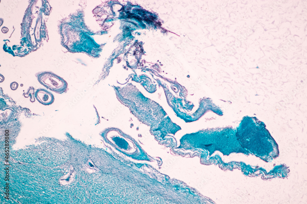 Cerebellum, Thalamus, Medulla oblongata, Spinal cord and Motor Neuron ...