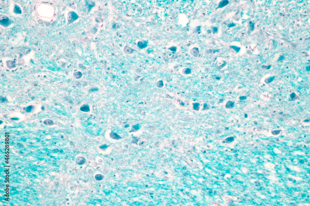 Cerebellum, Thalamus, Medulla oblongata, Spinal cord and Motor Neuron ...