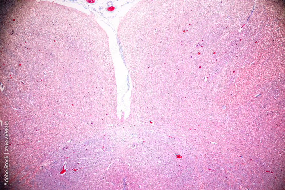 Cerebellum, Thalamus, Medulla oblongata, Spinal cord and Motor Neuron ...