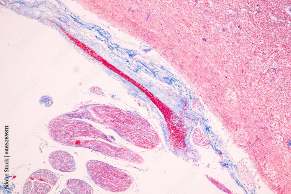 Cerebellum, Thalamus, Medulla oblongata, Spinal cord and Motor Neuron ...