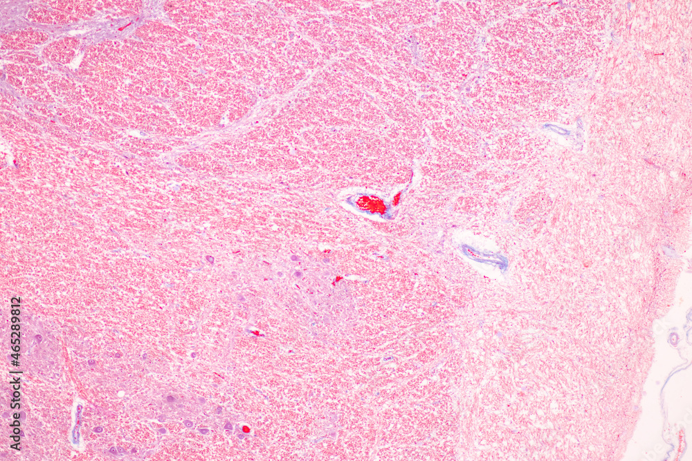 Cerebellum, Thalamus, Medulla oblongata, Spinal cord and Motor Neuron ...