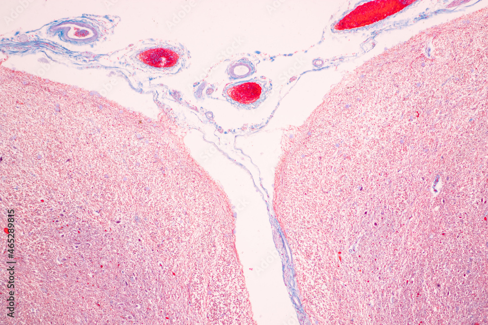 Cerebellum, Thalamus, Medulla oblongata, Spinal cord and Motor Neuron ...