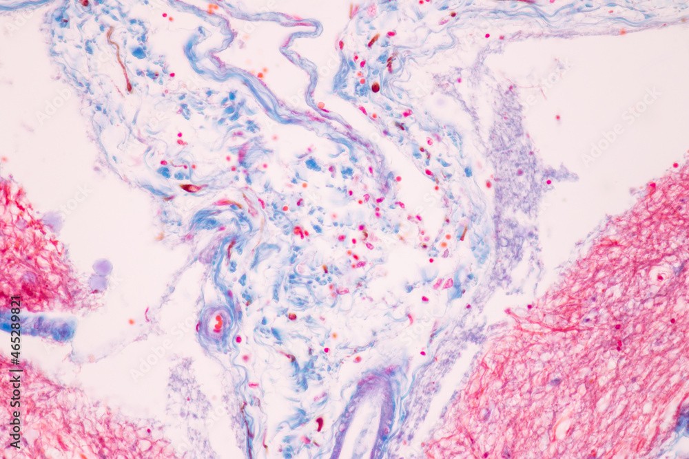 Cerebellum, Thalamus, Medulla oblongata, Spinal cord and Motor Neuron ...