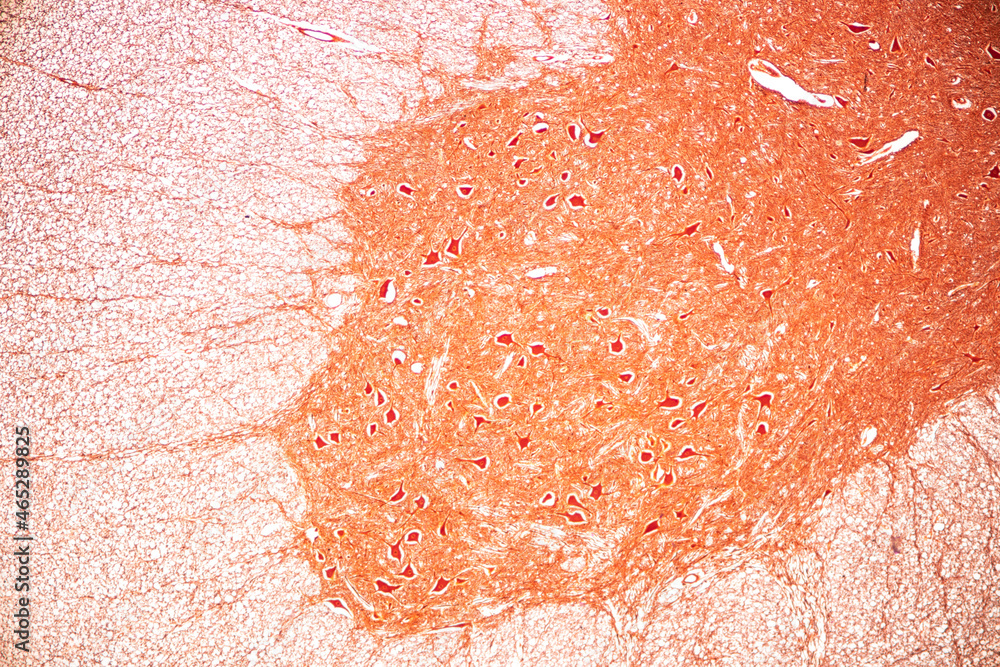 Cerebellum, Thalamus, Medulla oblongata, Spinal cord and Motor Neuron ...