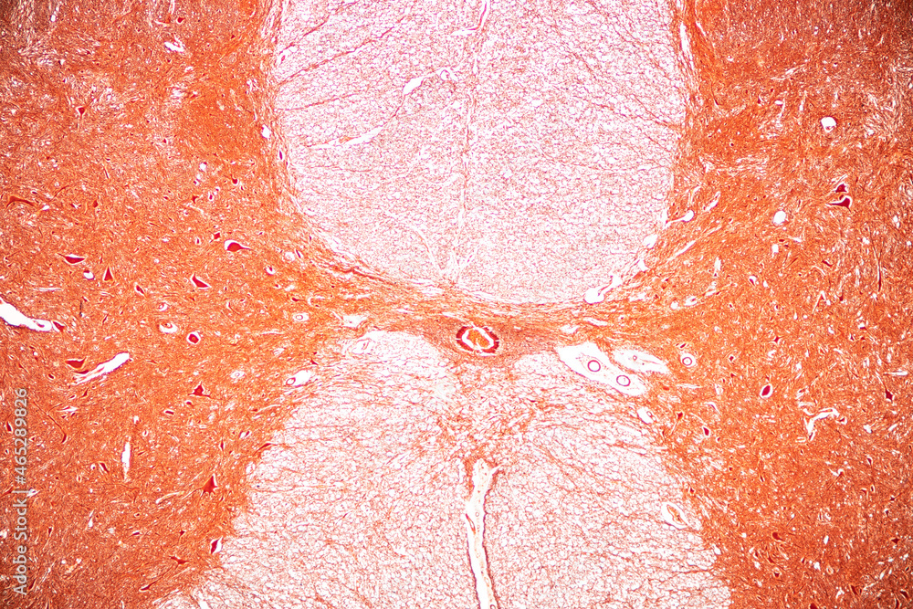 Cerebellum, Thalamus, Medulla oblongata, Spinal cord and Motor Neuron ...