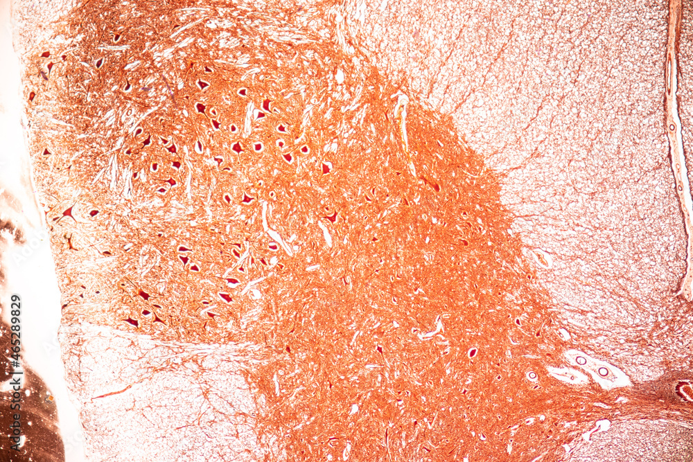 Cerebellum, Thalamus, Medulla oblongata, Spinal cord and Motor Neuron ...