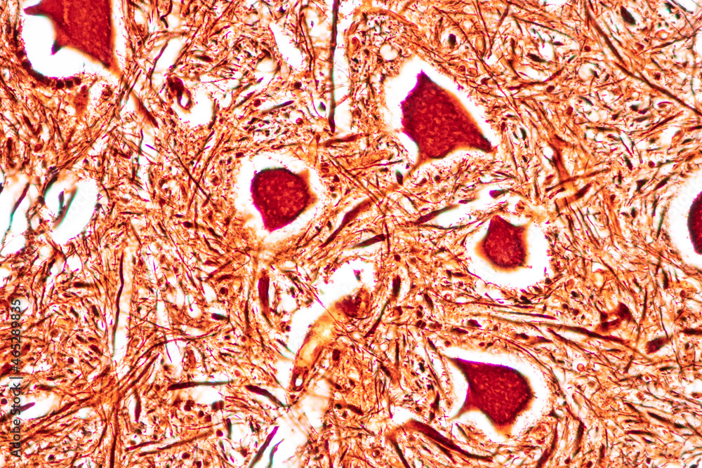Cerebellum, Thalamus, Medulla oblongata, Spinal cord and Motor Neuron ...