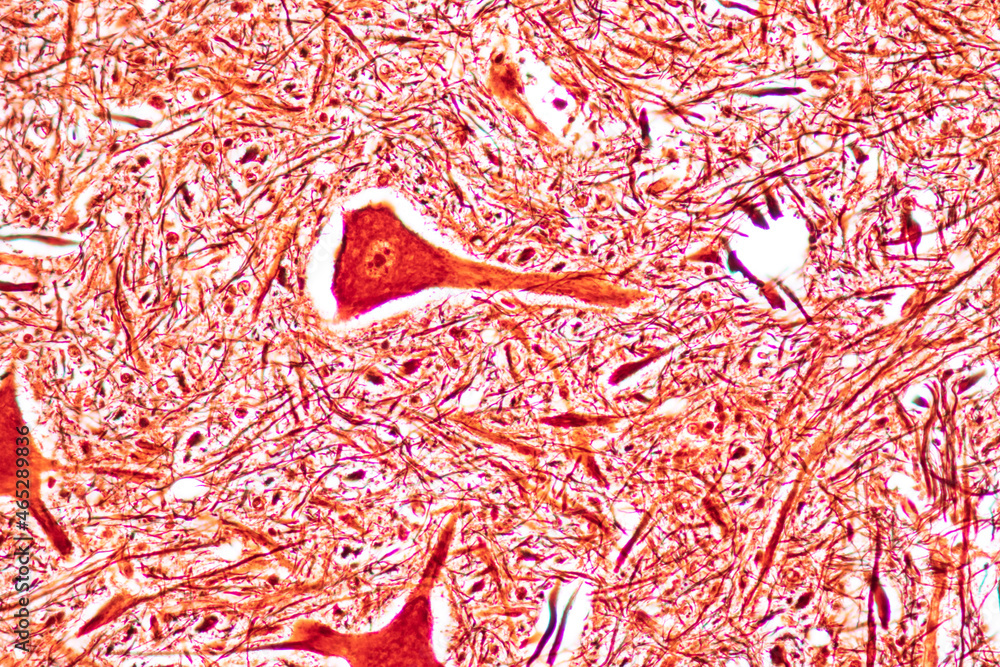 Cerebellum, Thalamus, Medulla oblongata, Spinal cord and Motor Neuron ...