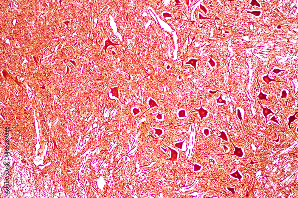 Cerebellum, Thalamus, Medulla oblongata, Spinal cord and Motor Neuron ...