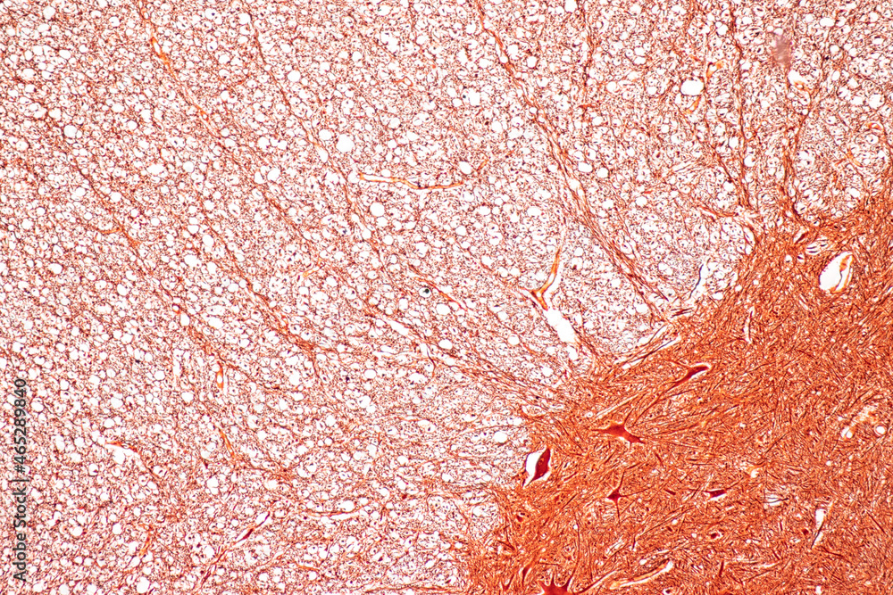 Foto de Cerebellum, Thalamus, Medulla oblongata, Spinal cord and Motor ...