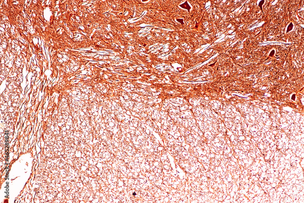 Cerebellum, Thalamus, Medulla oblongata, Spinal cord and Motor Neuron ...