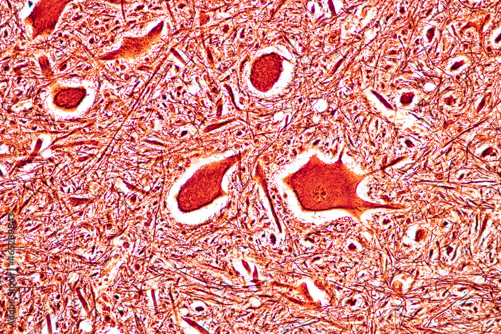 Cerebellum, Thalamus, Medulla oblongata, Spinal cord and Motor Neuron ...