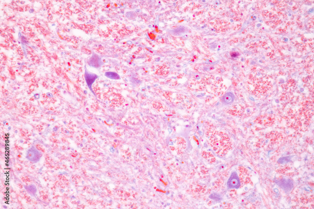Cerebellum, Thalamus, Medulla oblongata, Spinal cord and Motor Neuron ...