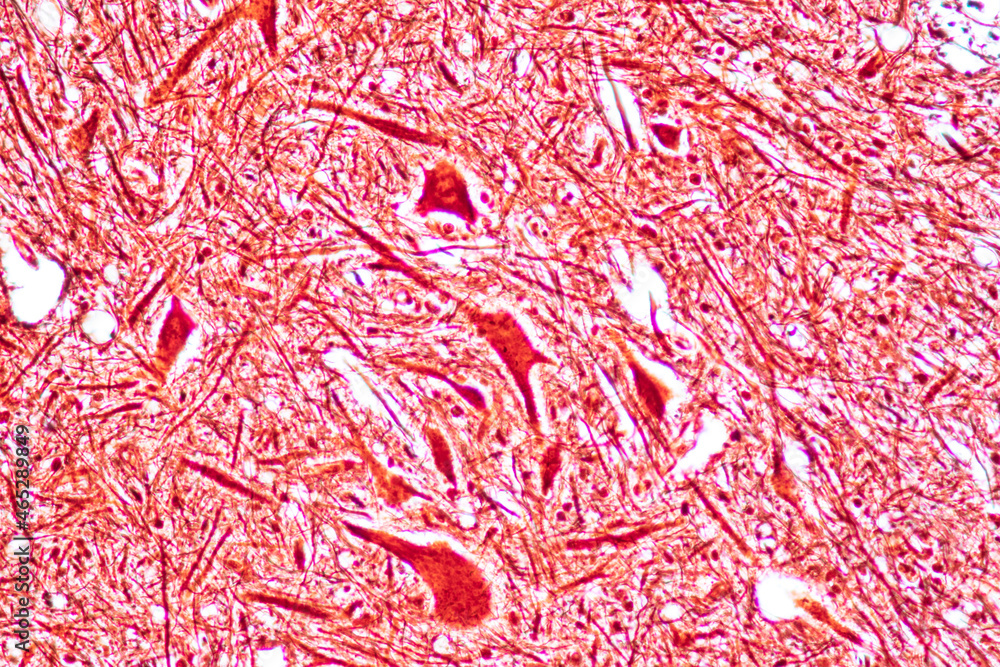 Foto de Cerebellum, Thalamus, Medulla oblongata, Spinal cord and Motor ...