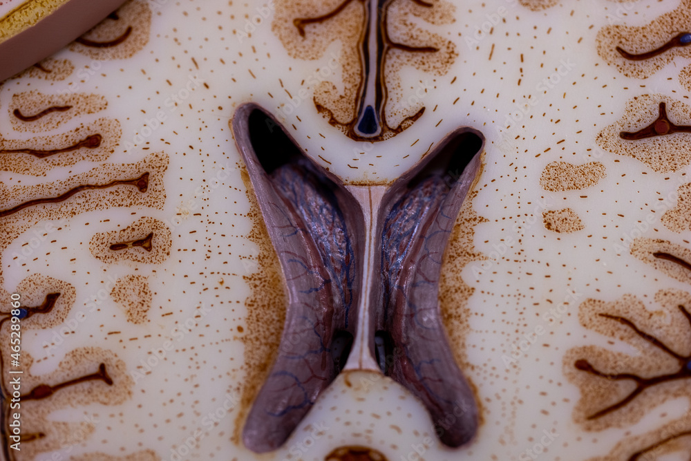 Cerebellum, Thalamus, Medulla oblongata, Spinal cord and Motor Neuron ...