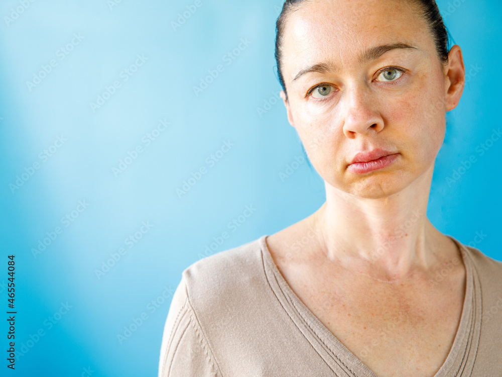 Teeth Problem. Gumboil, flux, bruise and swelling of cheek. Closeup Of ...