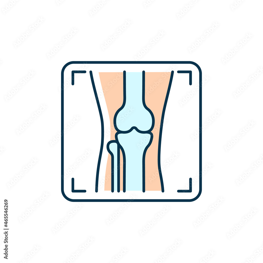 Arthritis x ray RGB color icon. Joint deformity depiction ...