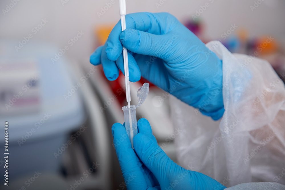 doctor's hands take a PCR test for covid from patient, a smear from ...