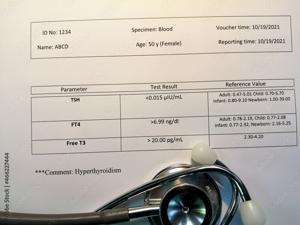 Hyperthyroidism. Abnormal report of thyroid function test isolated with ...