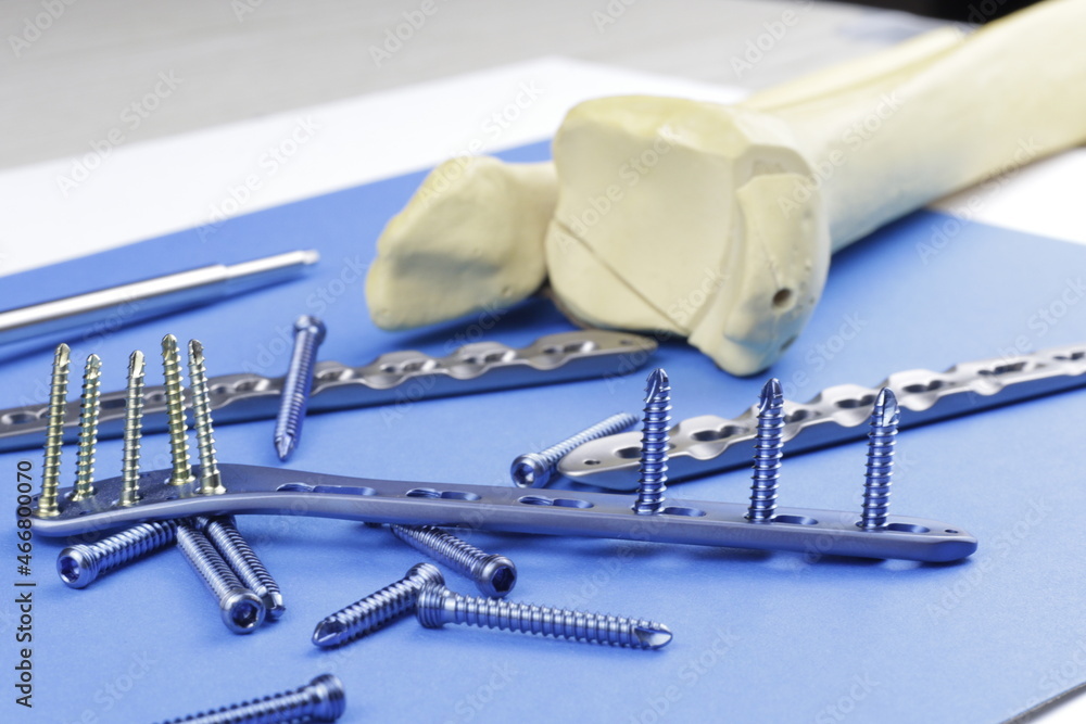 Surgical instruments for operation bone fractures Stock Photo | Adobe Stock