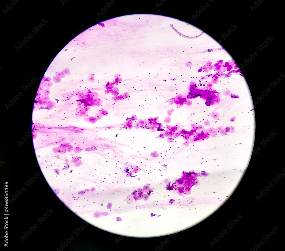 Squamous epithelial cells under microscope 40x view for education ...